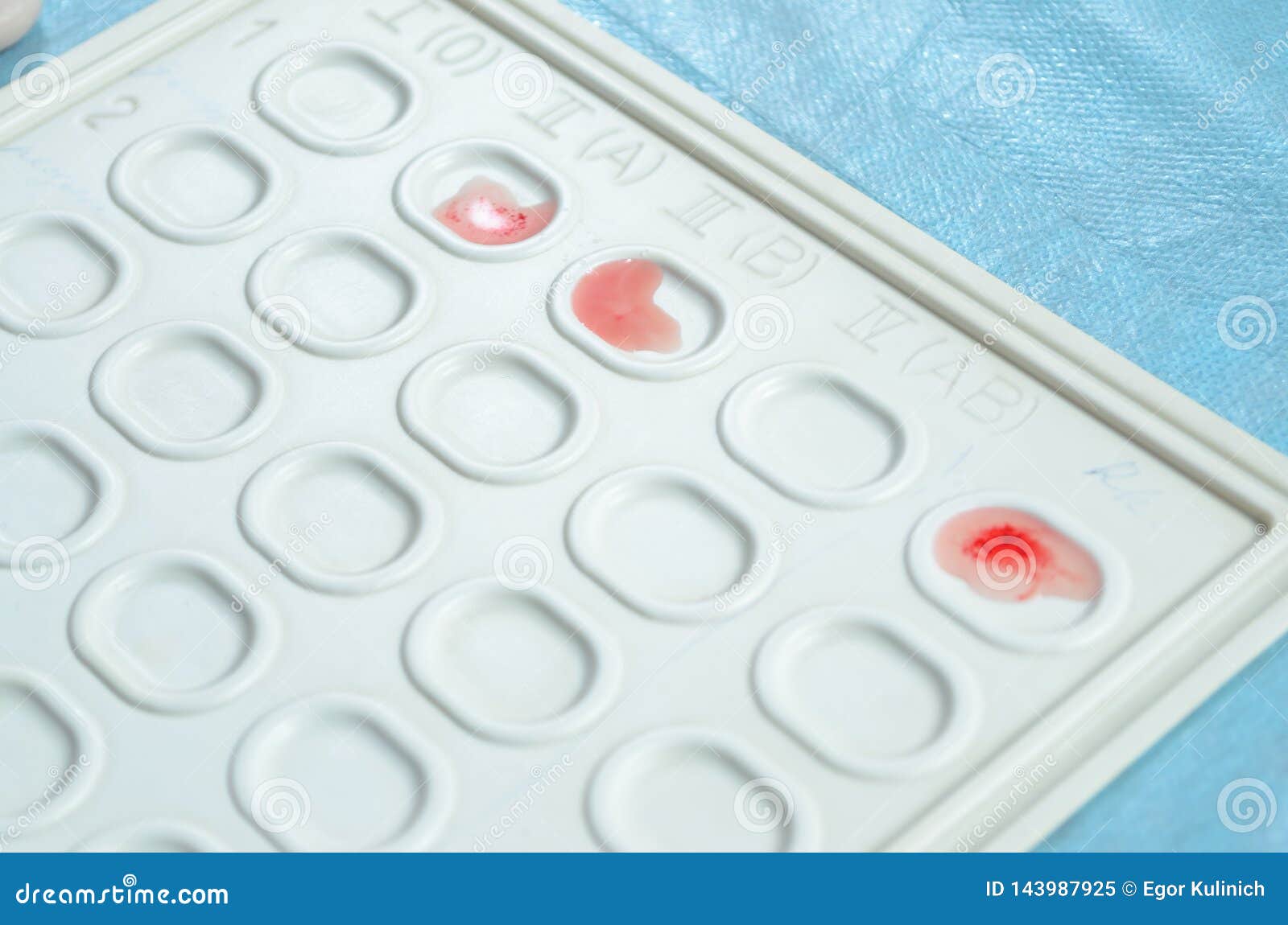 Blood Group and Rh Factor Testing Stock Image - Image of expertise ...