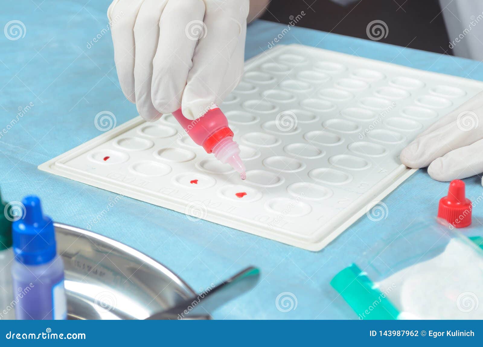 Blood Group and Rh Factor Testing Stock Photo - Image of donation ...
