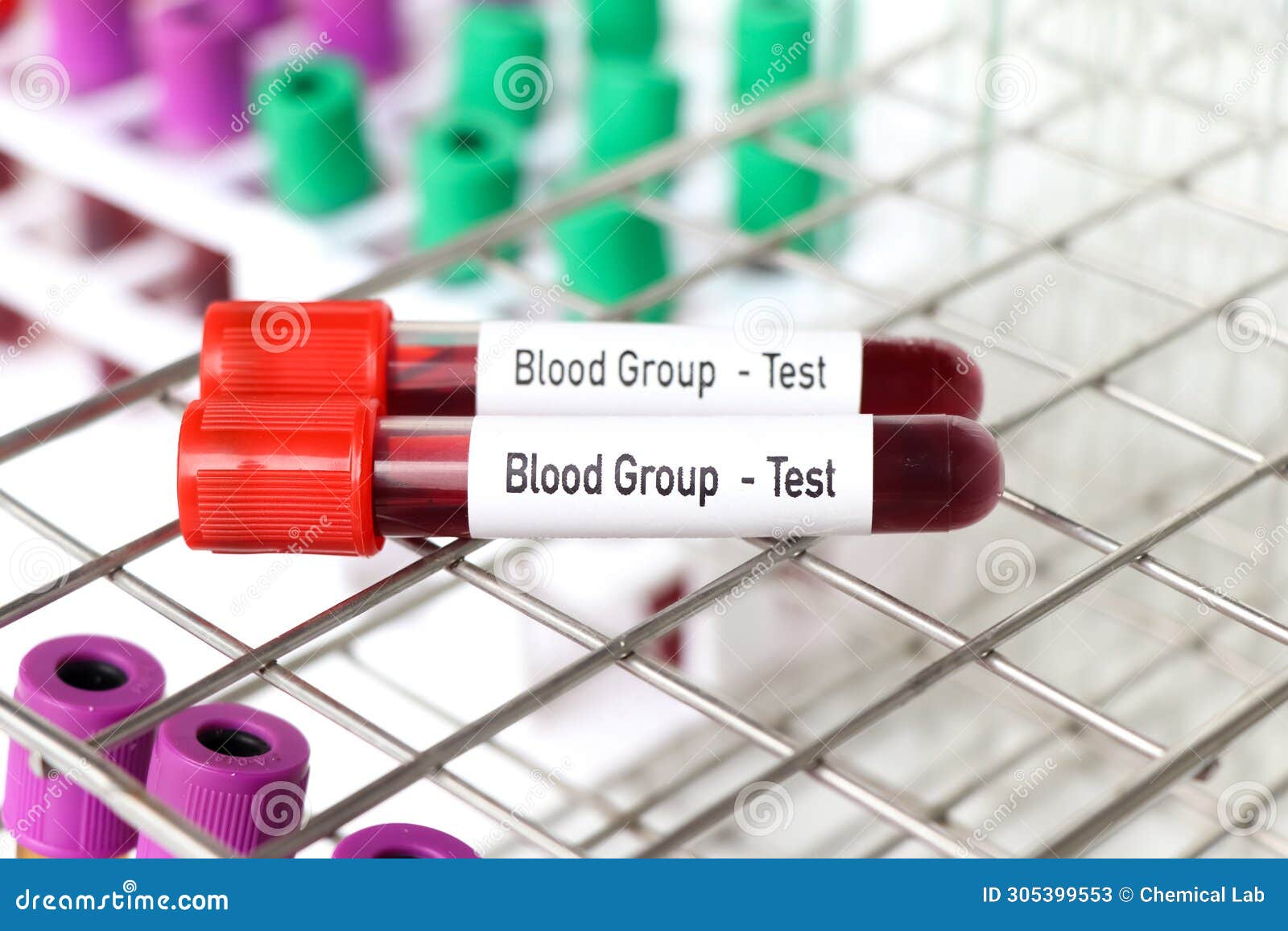 Blood Group Test, Blood Sample To Analyze in the Laboratory Stock Image ...