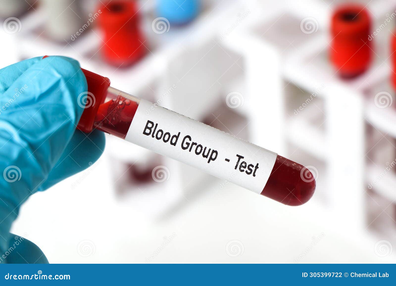 Blood Group Test, Blood Sample To Analyze in the Laboratory Stock Photo ...