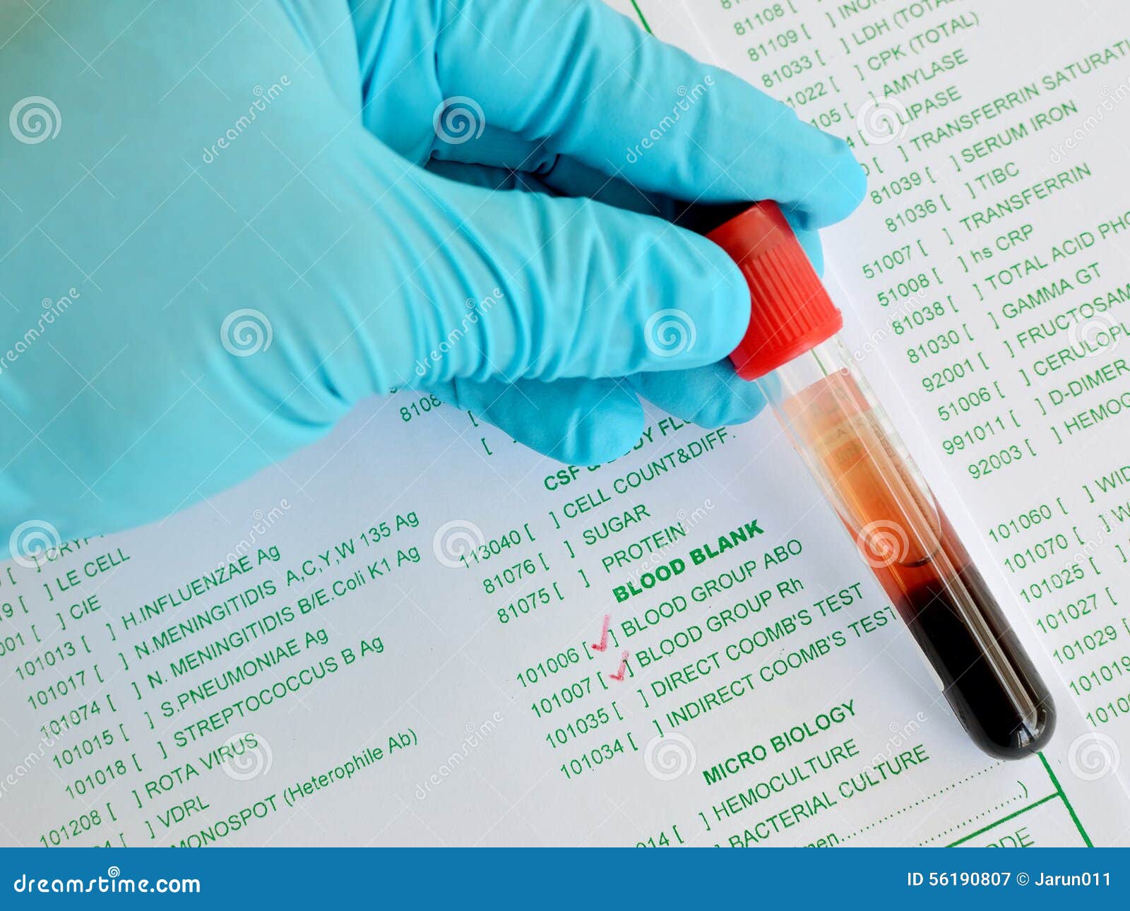 Blood group testing stock image. Image of science, test - 56190807