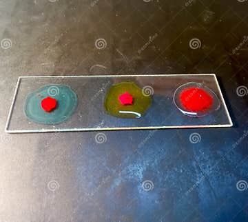 Blood Grouping Test by Slide Agglutination Method, ABO Stock Photo ...