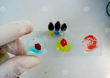 Blood Group Testing by Slide Agglutination Method. Blood Grouping Stock ...