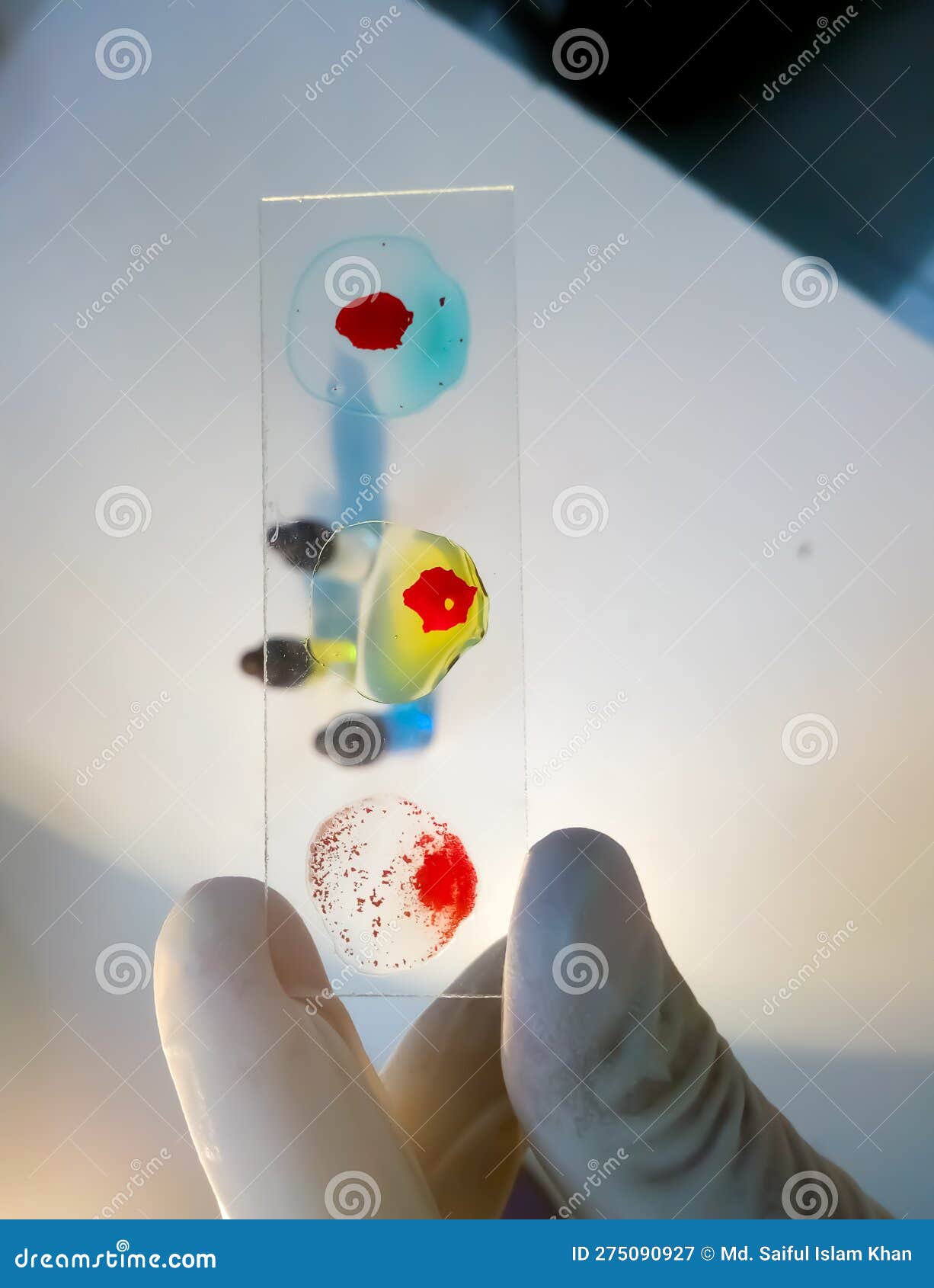Blood Grouping Testing by Slide Agglutination Method. Stock Image ...