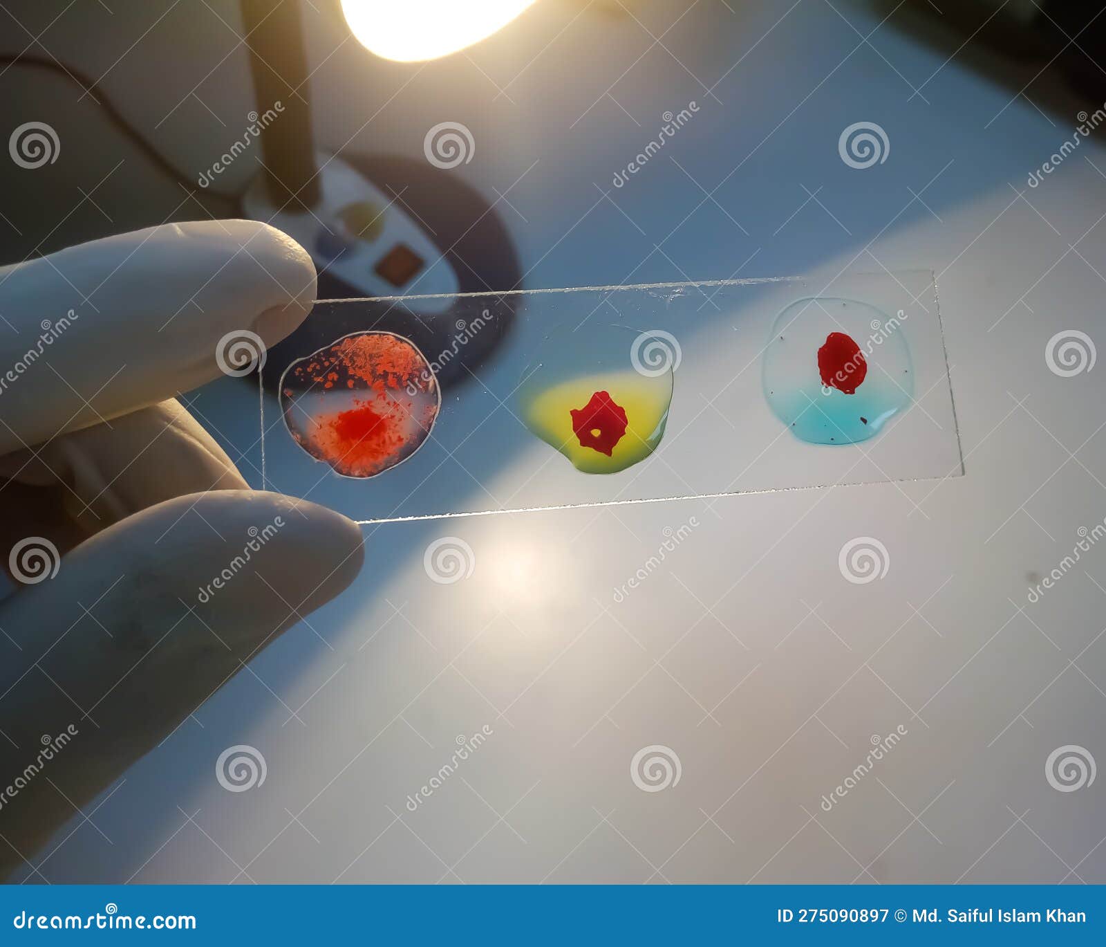 Blood Group Testing by Slide Agglutination Method in Lab Stock Image ...