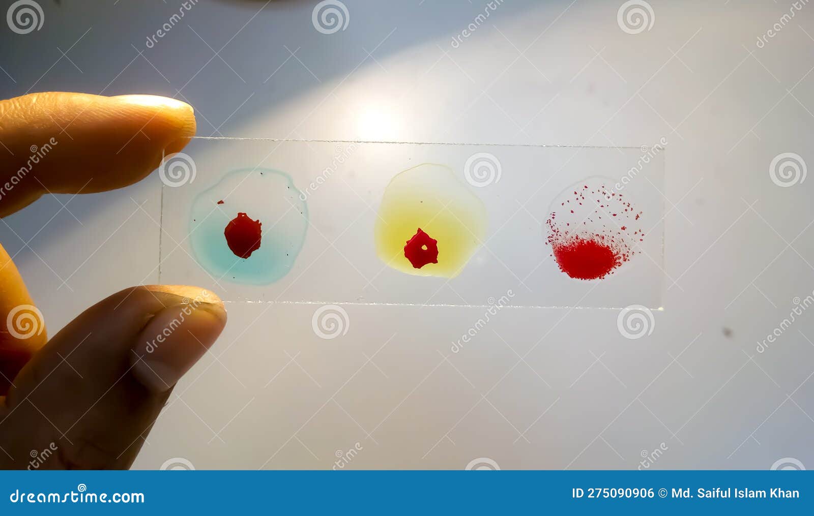 Blood Grouping Testing. Blood Grouping Stock Photo - Image of ...