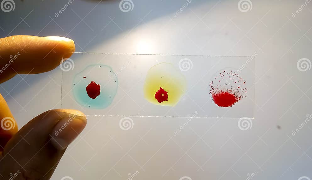 Blood Grouping Testing. Blood Grouping Stock Photo - Image of ...