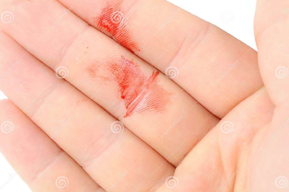 Blood on Hand stock photo. Image of stain, bloody, drop - 21662796