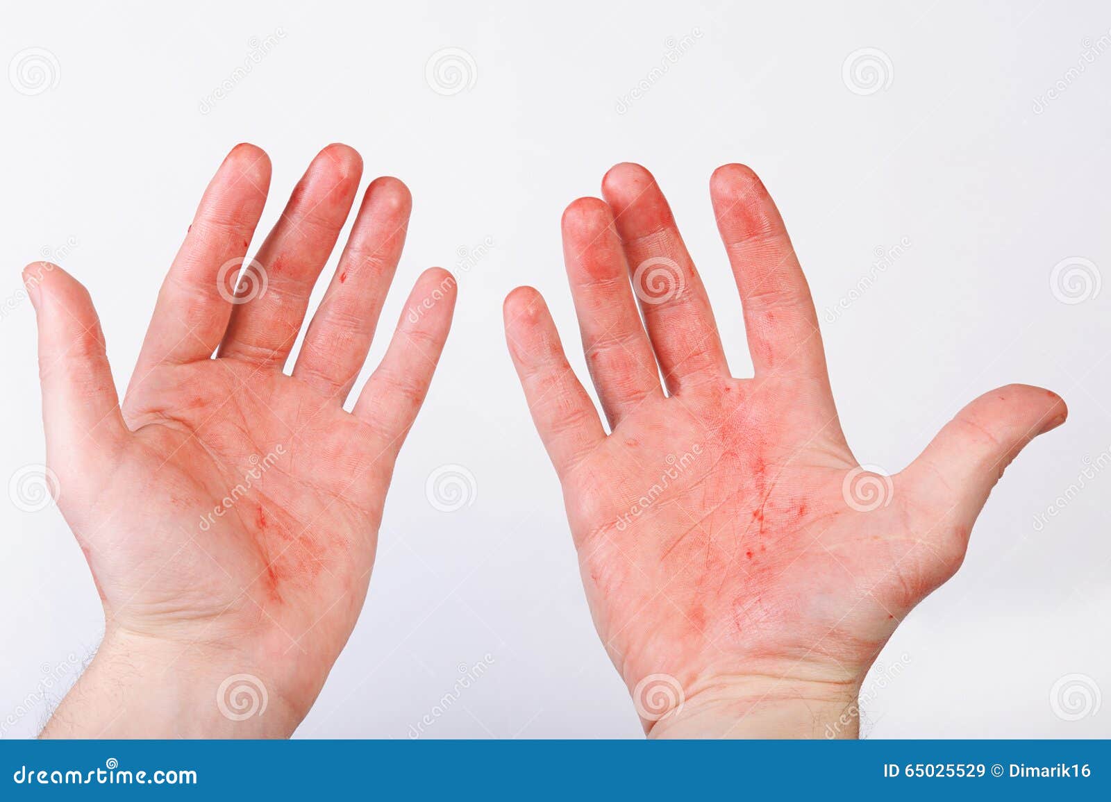 Blood on hands stock image. Image of background, pain - 65025529