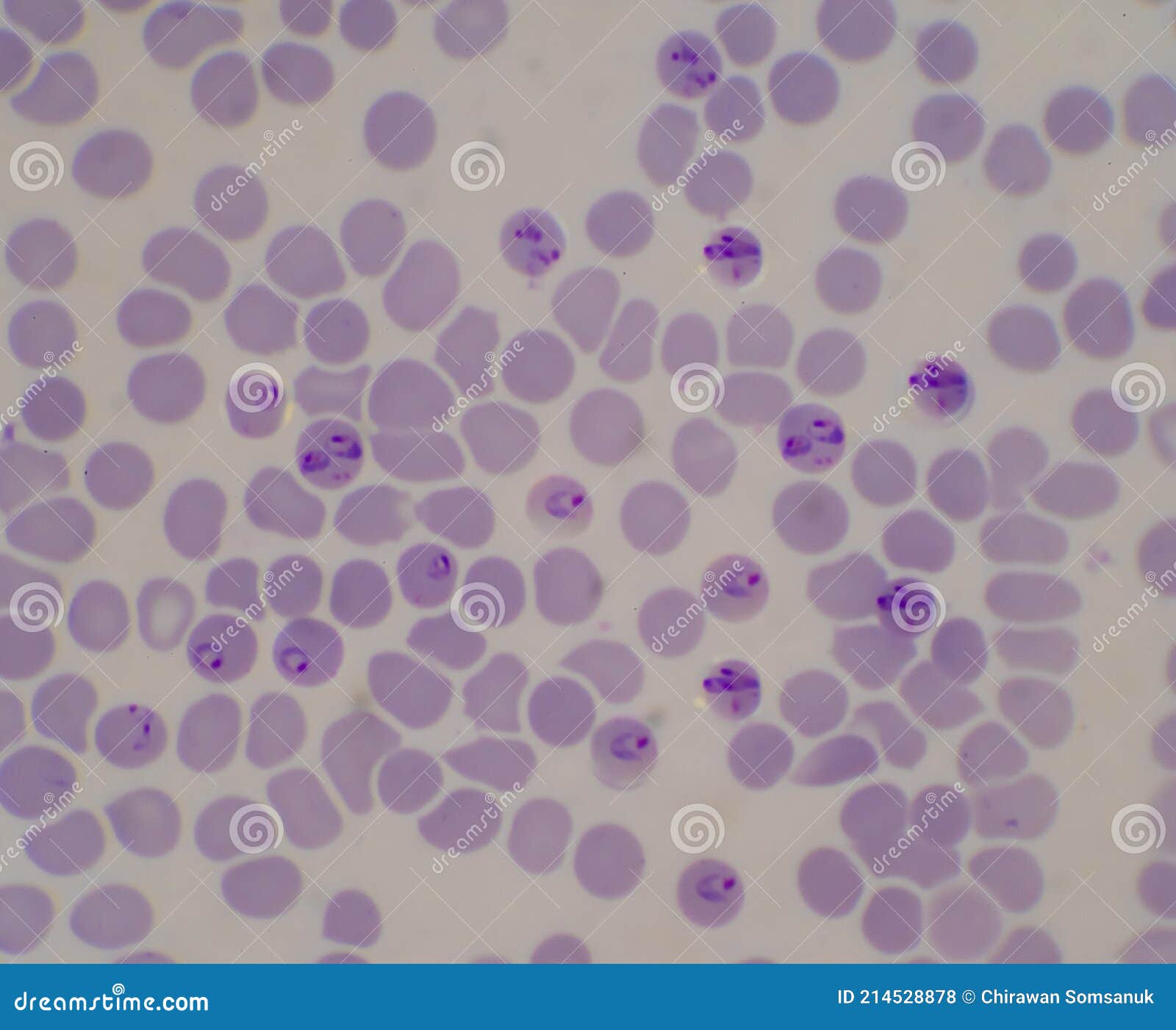 Malaria Red Blood Cell Stock Photos - Free & Royalty-Free Stock Photos ...