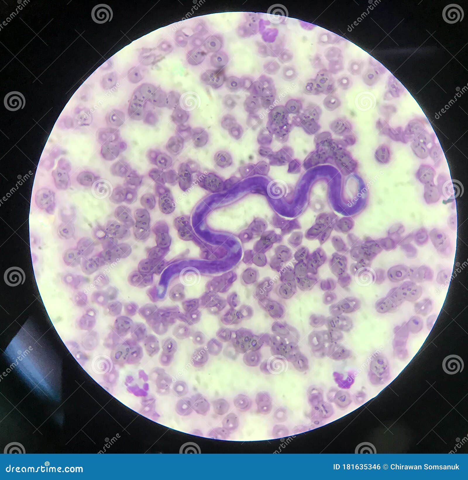 Microphilaria on Red Blood Cells Background Stock Photo - Image of ...