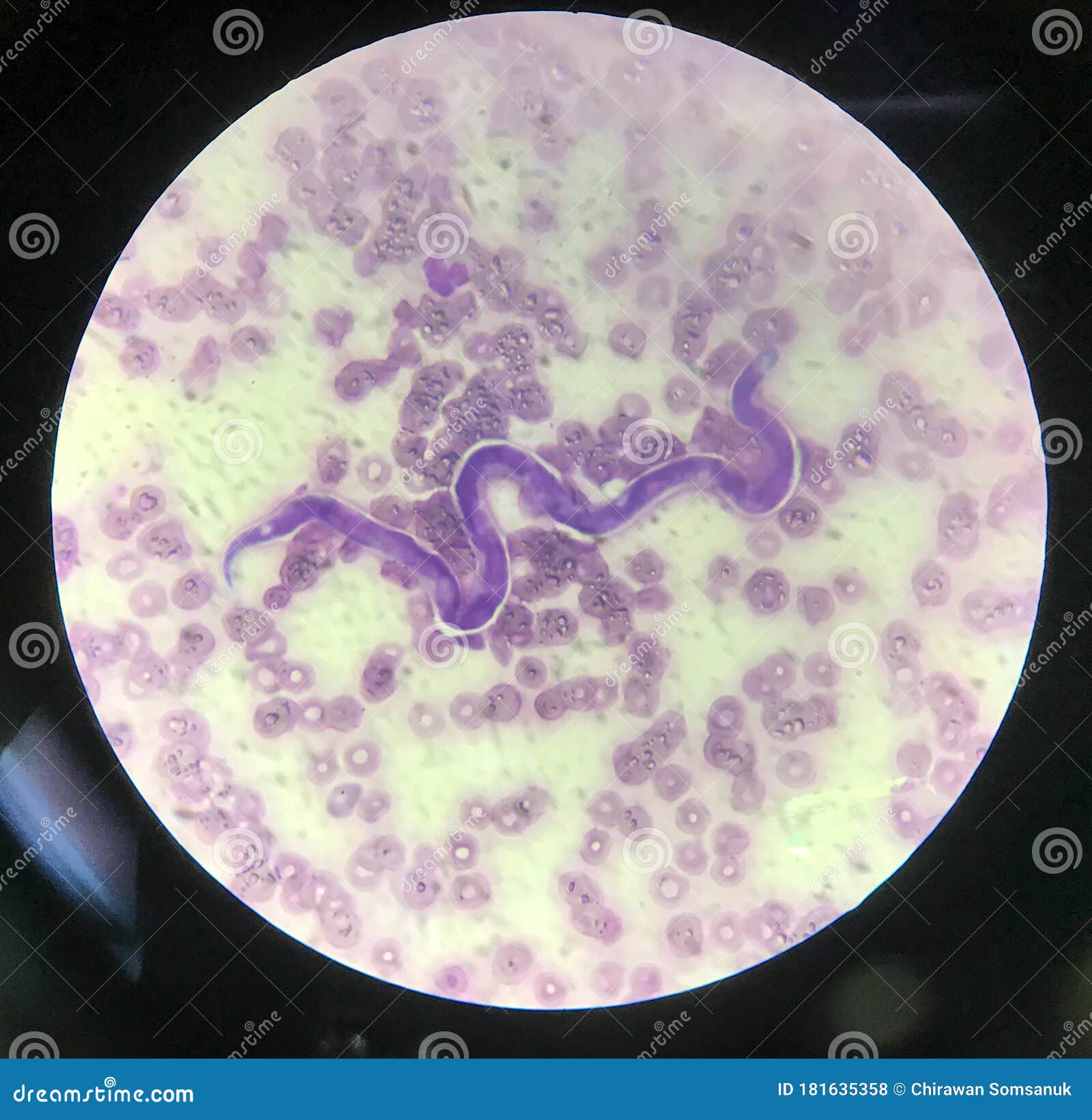 Microphilaria on Red Blood Cells Background Stock Photo - Image of ...