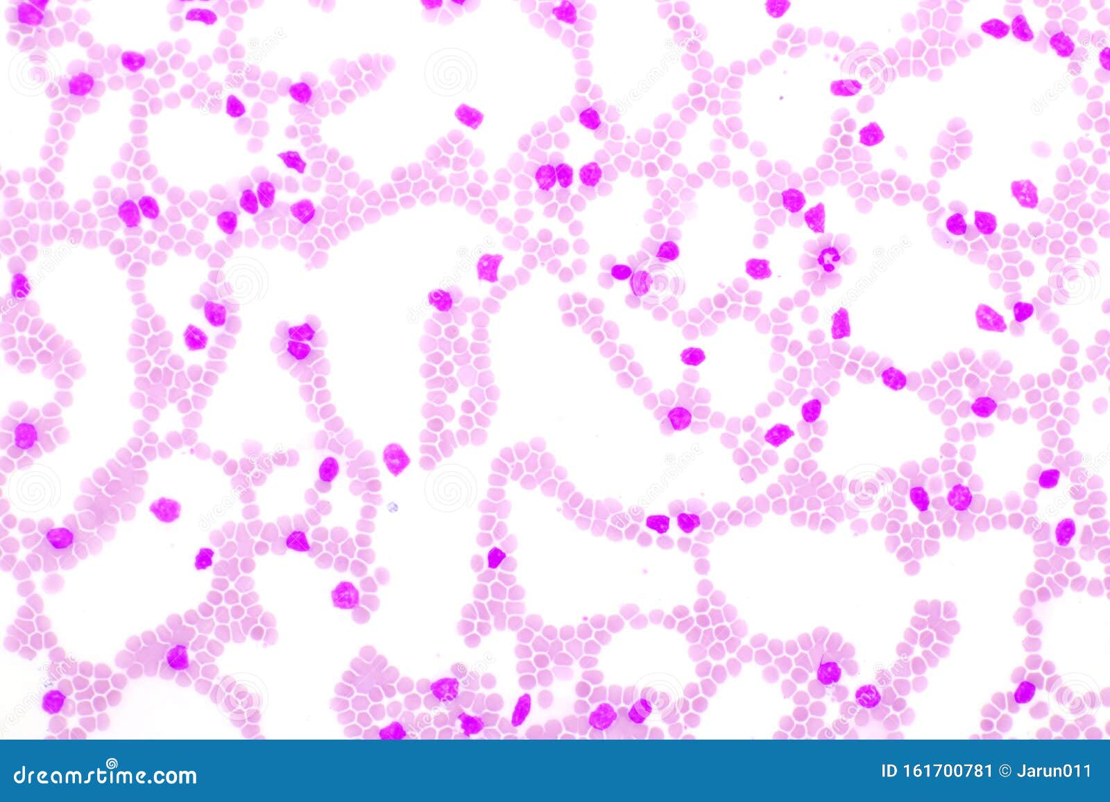 213 Cll Blood Stock Photos - Free & Royalty-Free Stock Photos from ...