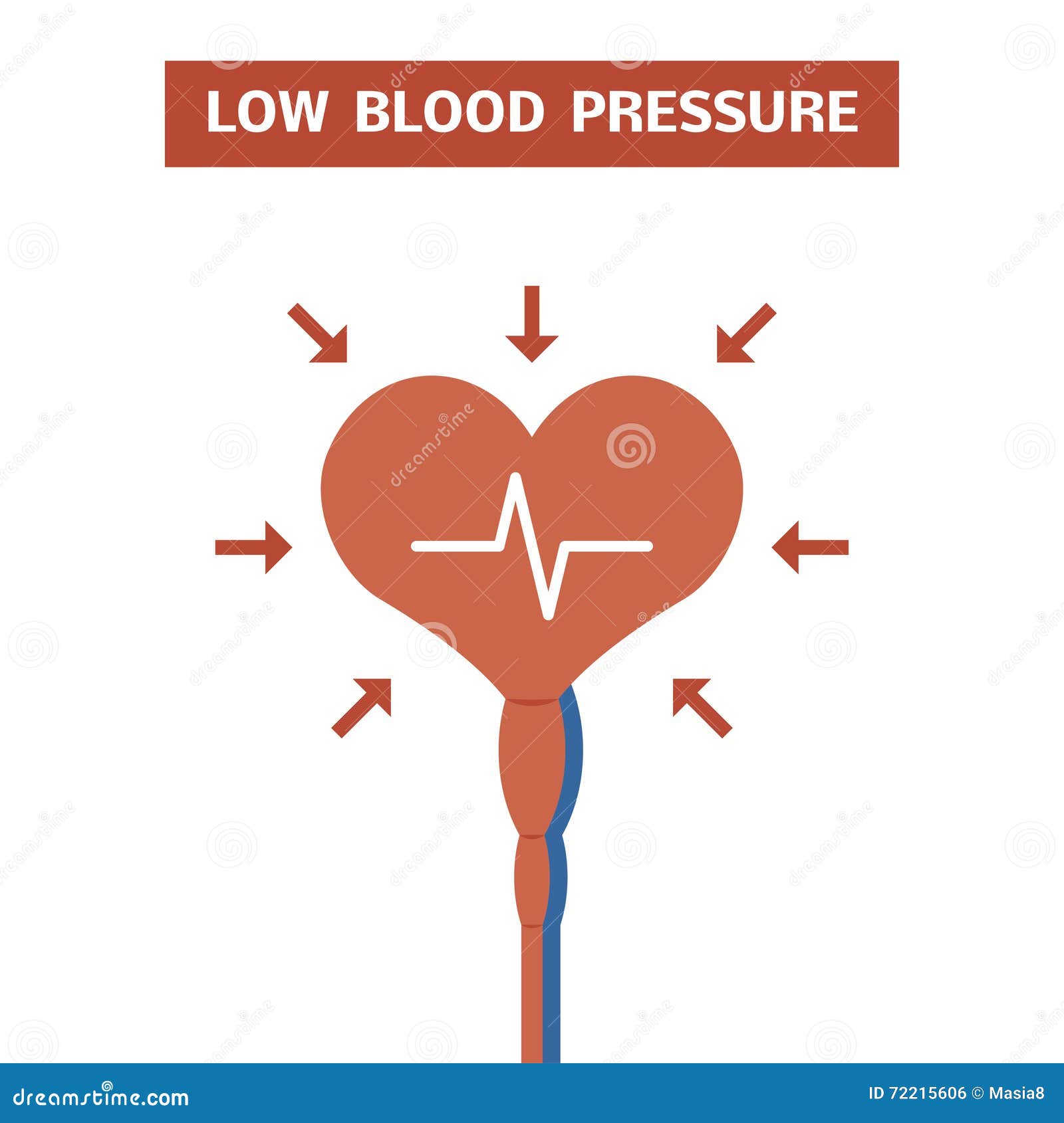 Hypotension Low Blood Pressure Cartoon Illustration Royalty-Free Stock ...