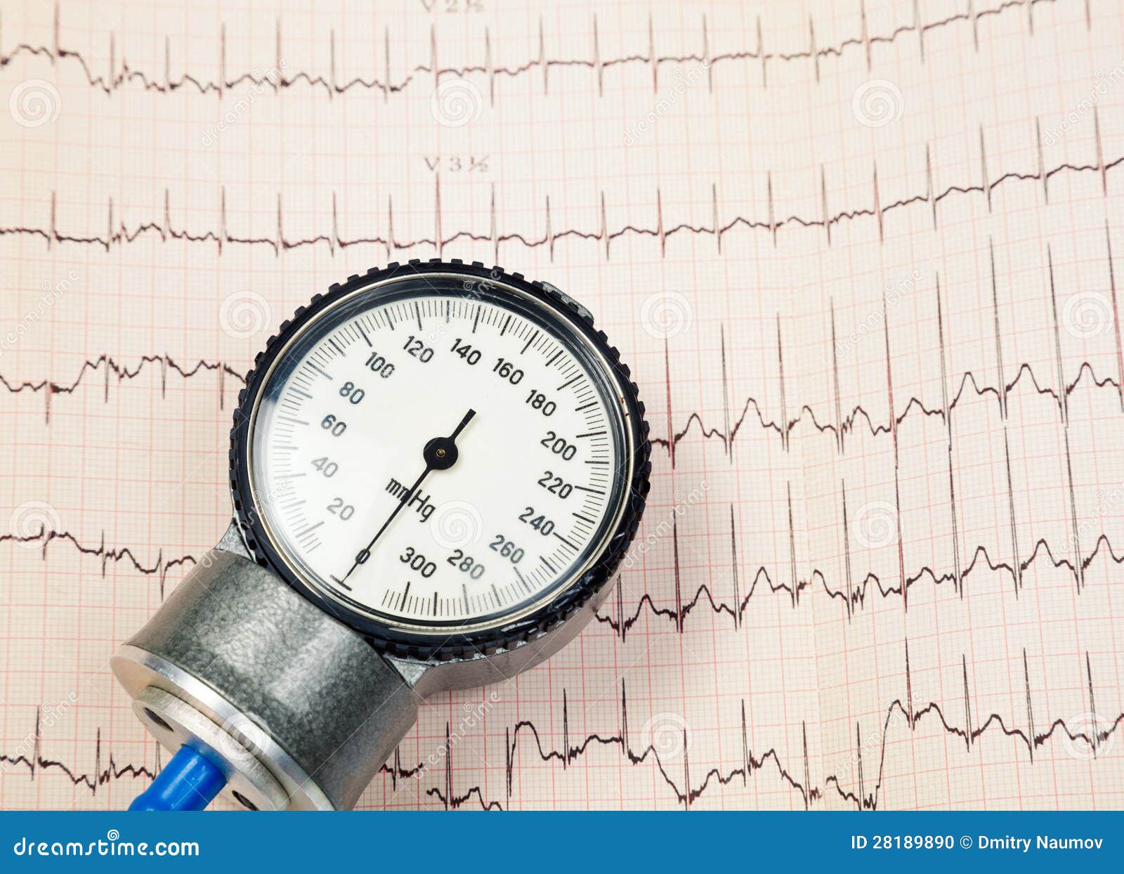 Blood Pressure Manometer on EKG Stock Photo - Image of chart, exam ...