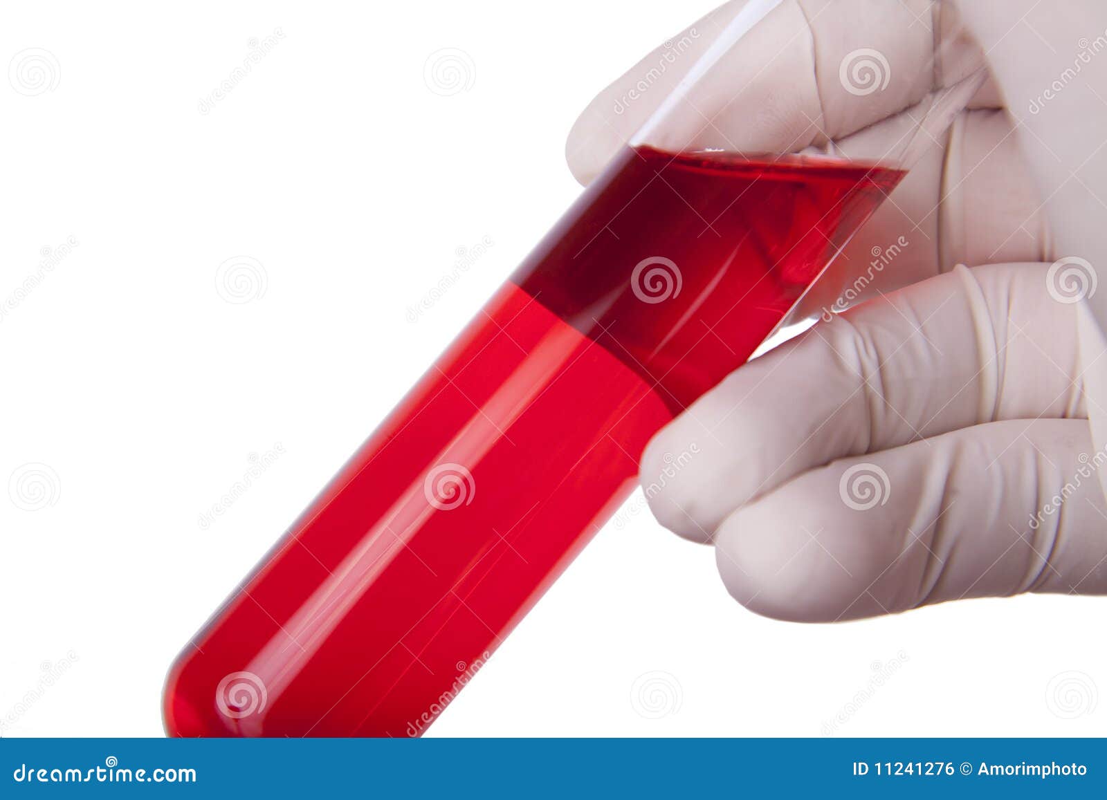 Blood sample stock photo. Image of chemical, analysis - 11241276