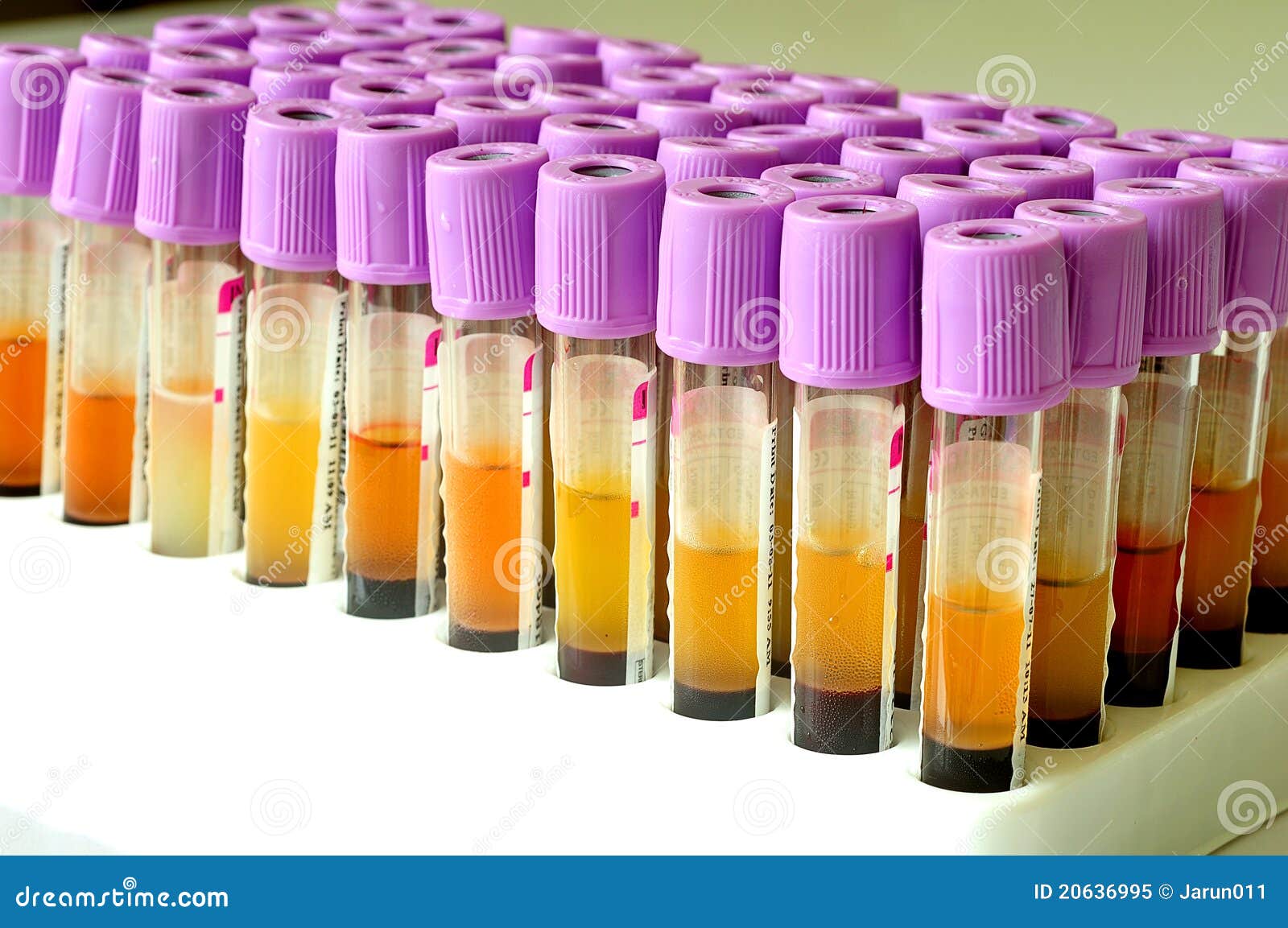 Blood sample stock image. Image of hematology, tubes - 20636995
