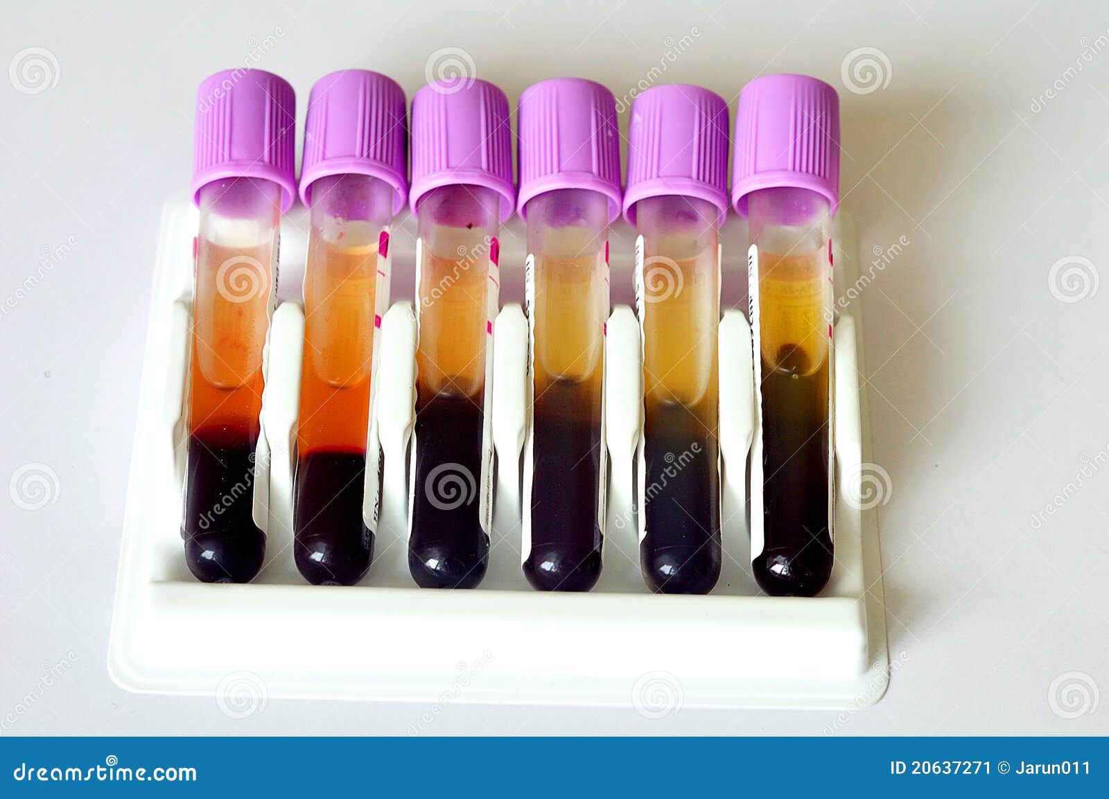 Blood sample stock image. Image of experiment, health - 20637271