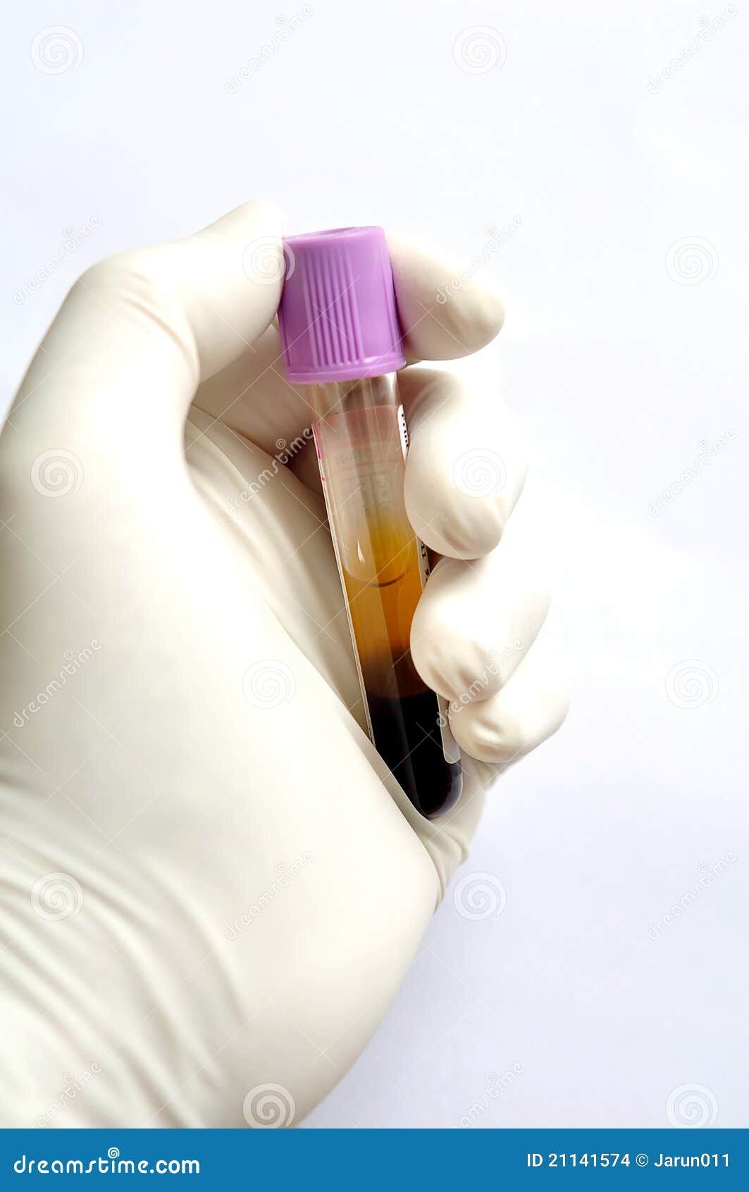Blood Sample Picture. Image: 21141574