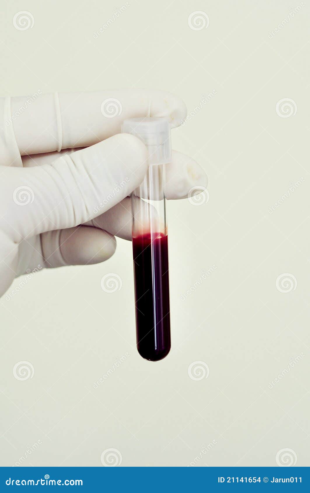 Blood sample stock photo. Image of tube, medical, test - 21141654