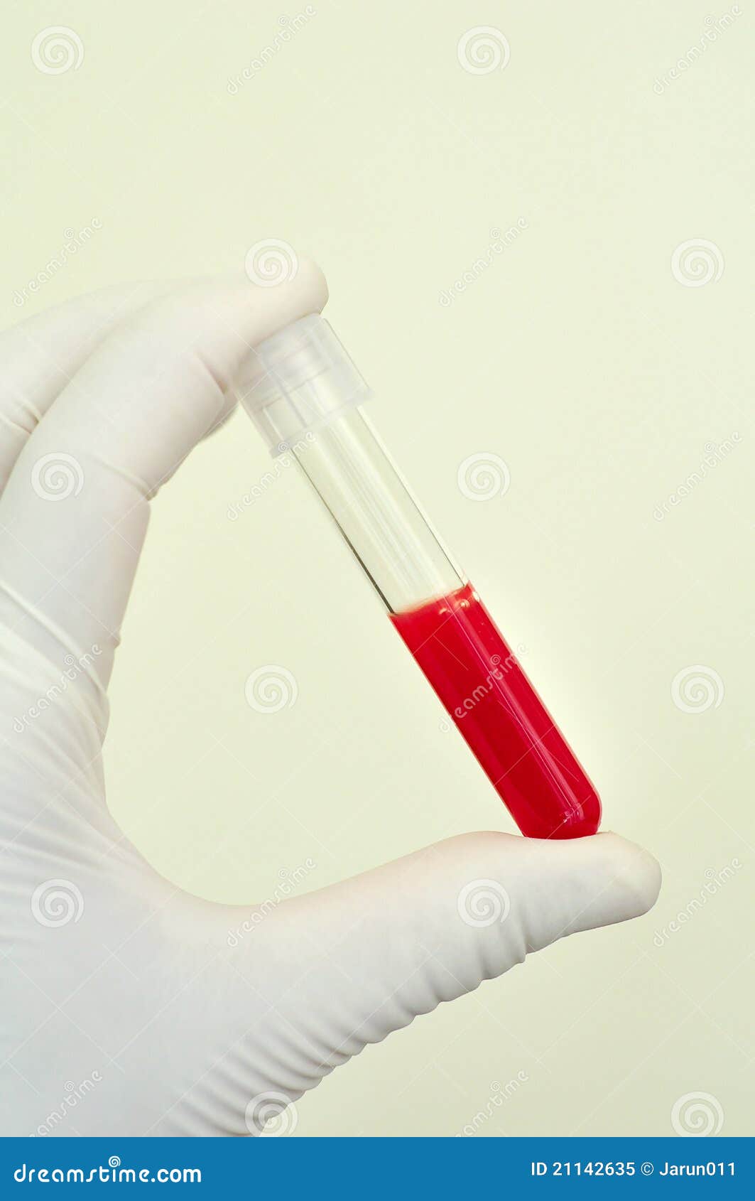 Blood sample stock image. Image of laboratory, analyzing - 21142635