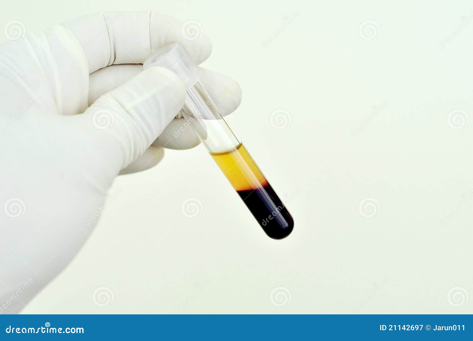 Blood sample stock image. Image of sanguineous, biotechnology - 21142697