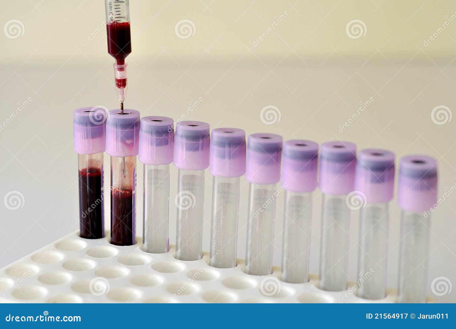 Blood sample stock image. Image of scientific, test, hematology - 21564917