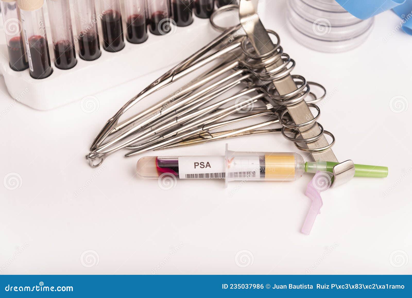 Blood Sample with Abnormal High PSA Test Result. Stock Photo - Image of ...