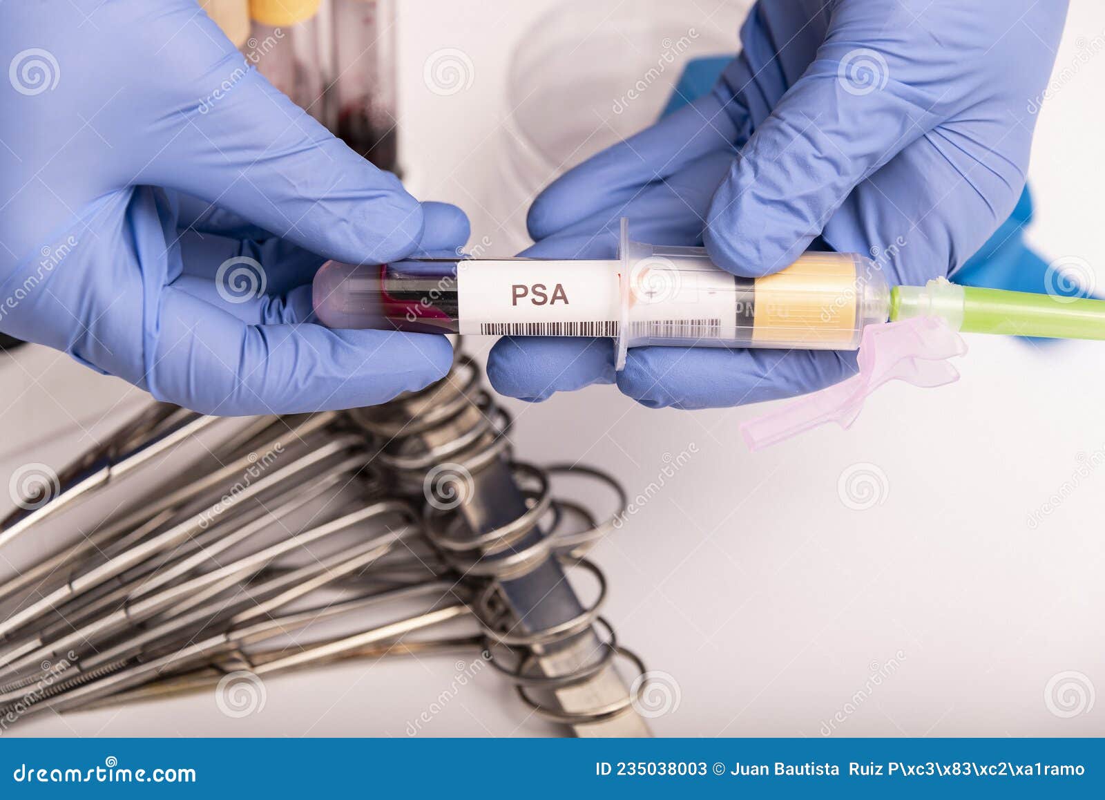 Blood Sample with Abnormal High PSA Test Result. Stock Image - Image of ...