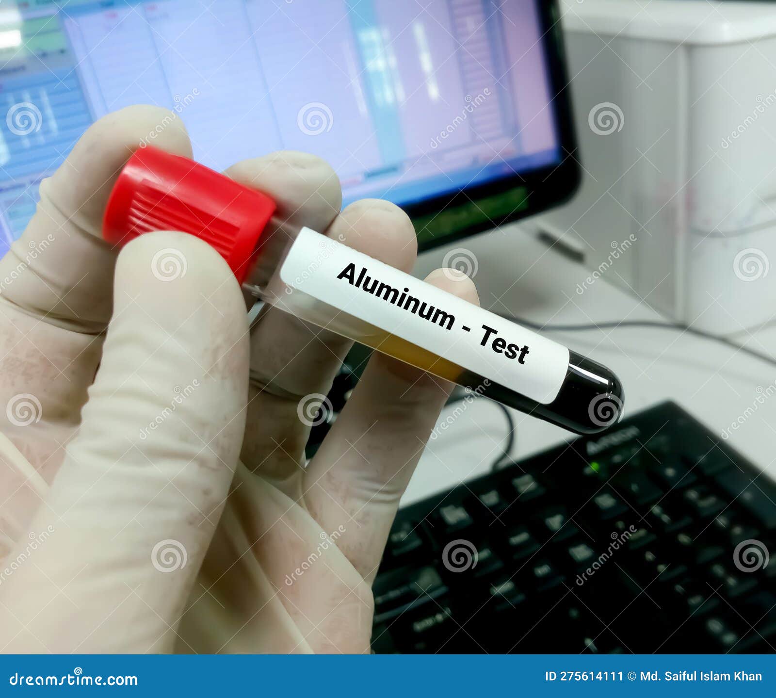 Aluminum test stock image. Image of metal, background - 275614111