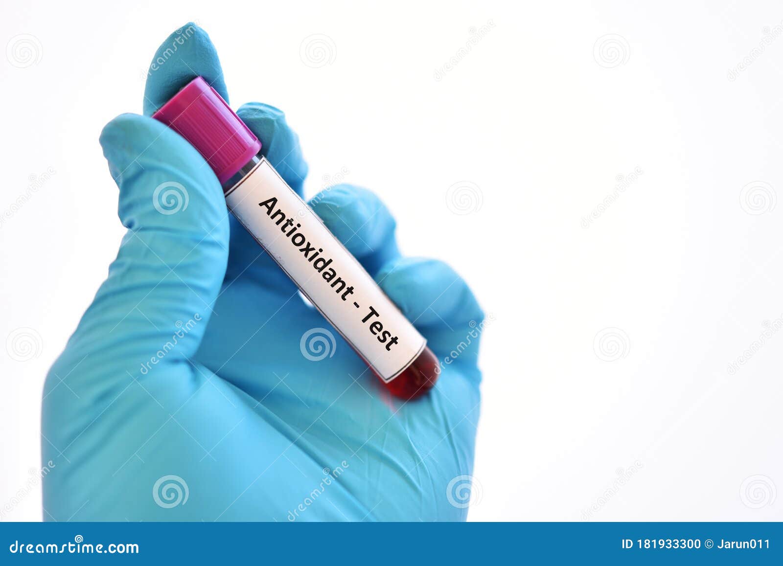 Blood Sample for Antioxidant Test Stock Photo - Image of bioactive ...