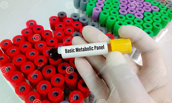 Basic metabolic panel test stock image. Image of tube - 278142449