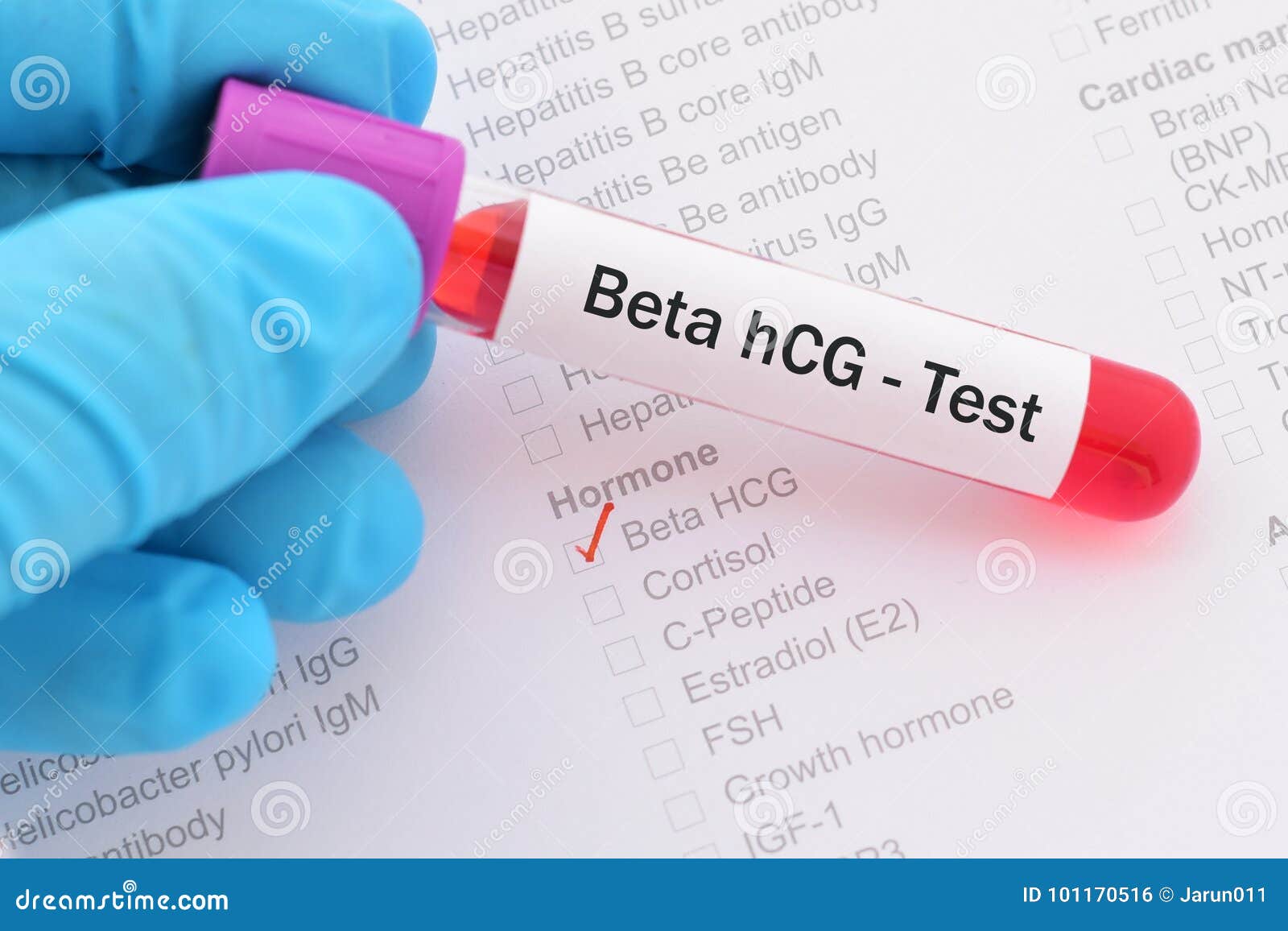 Beta Stock Photos - Royalty Free Pictures