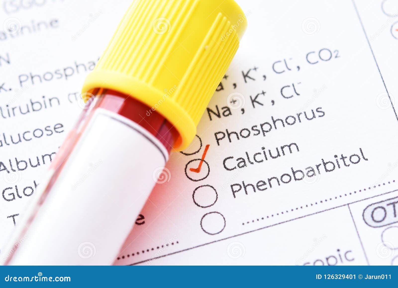 Blood Sample for Calcium Test Stock Image - Image of laboratory, exam ...