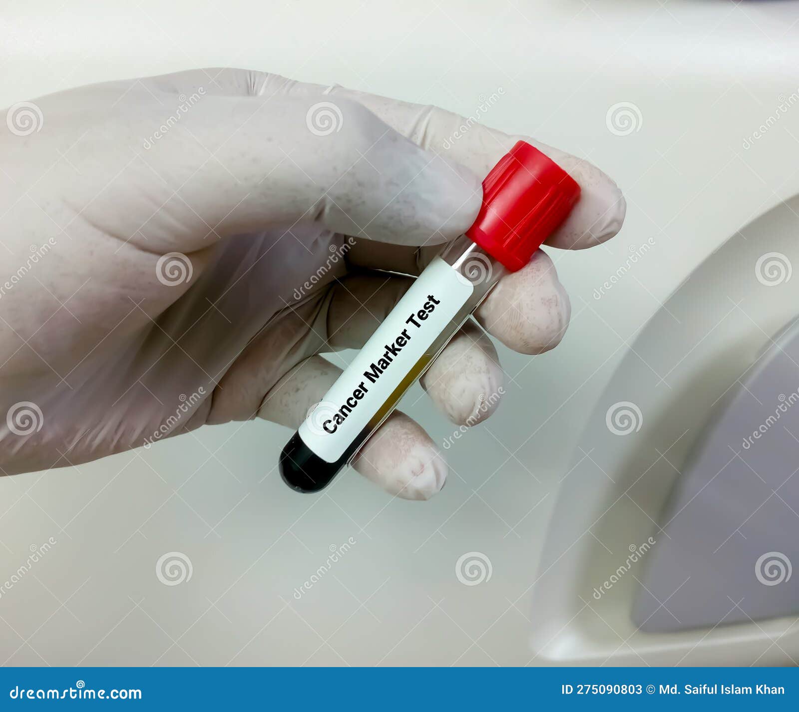 Blood Sample for Cancer Marker Test. Stock Image - Image of blood ...