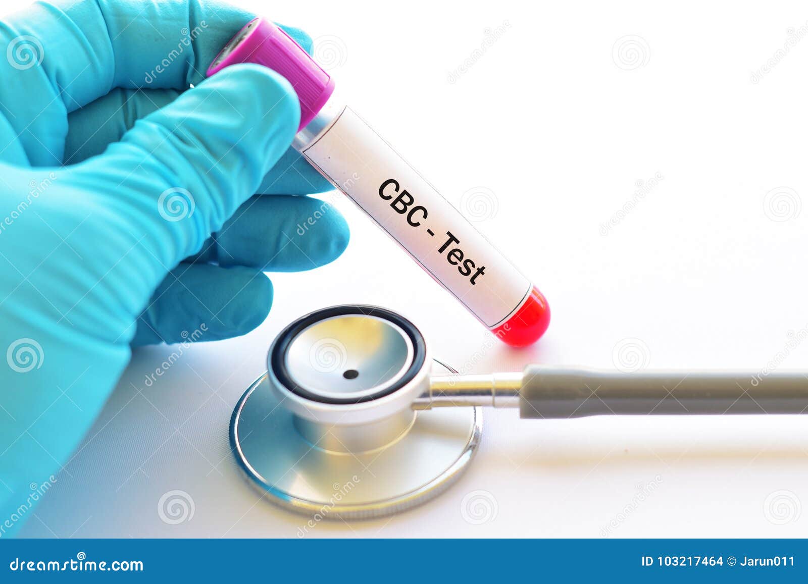 CBC test stock photo. Image of hospital, technology - 103217464