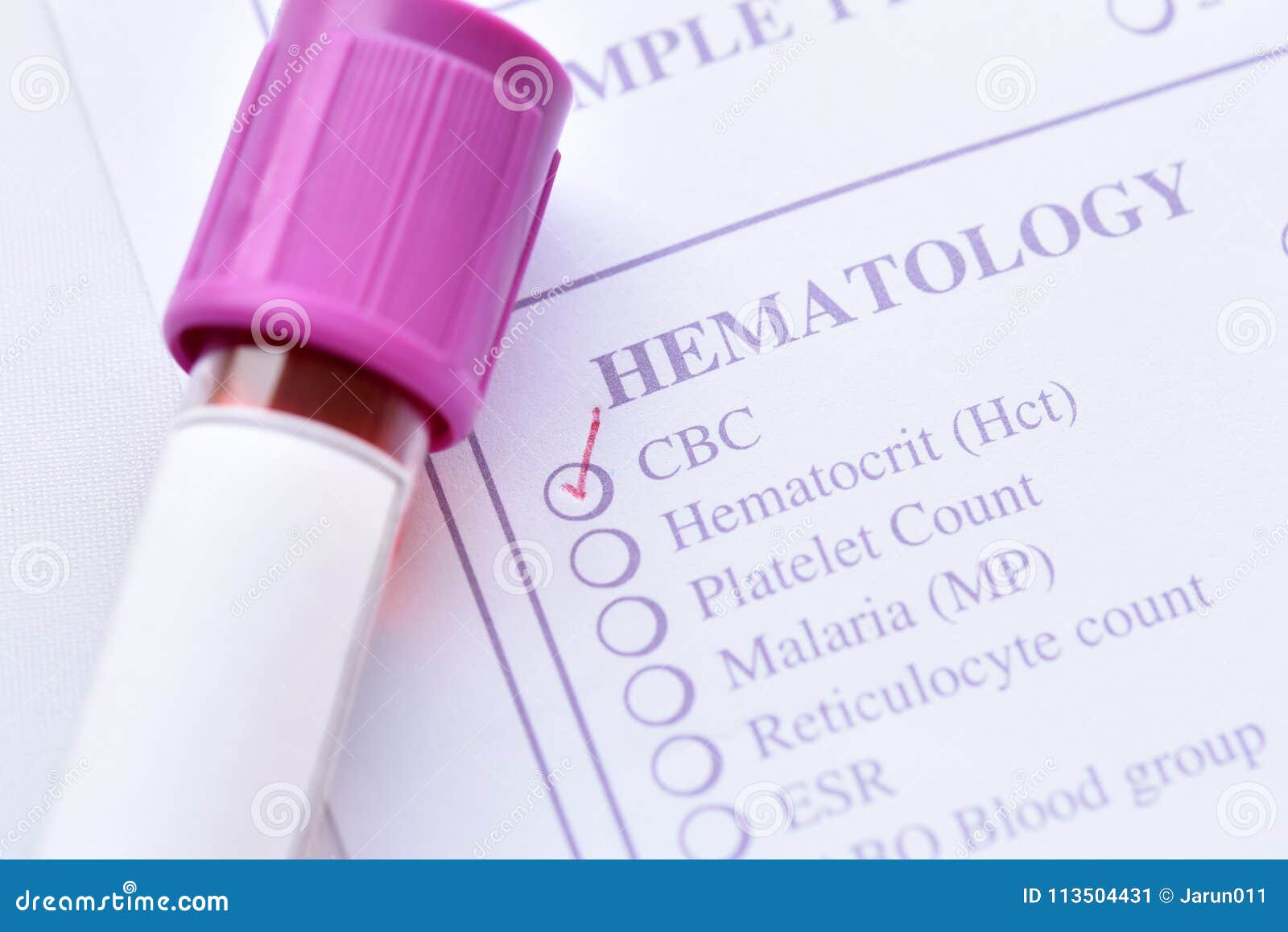 Blood for CBC test stock image. Image of medical, checkup - 113504431