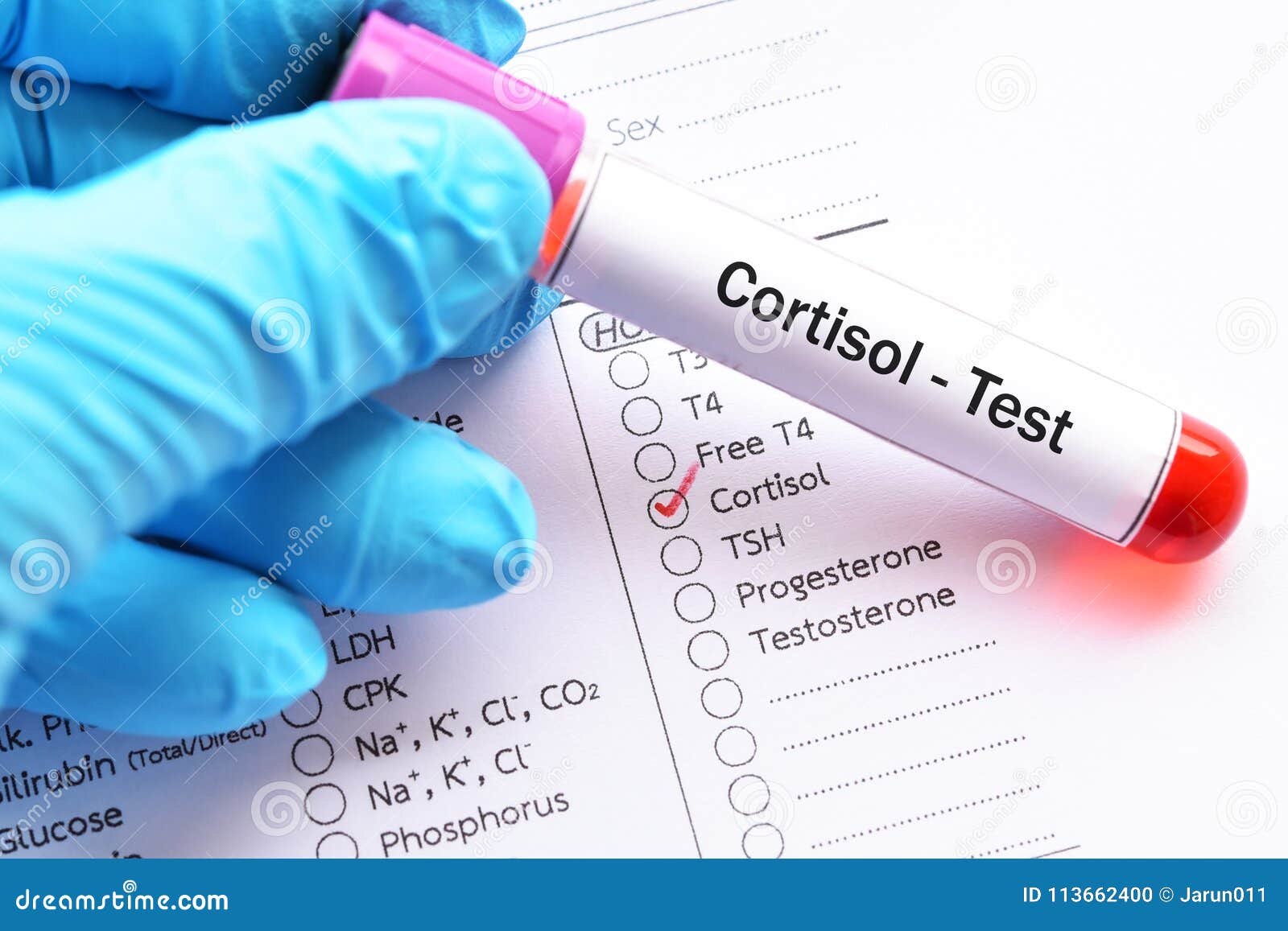 Cortisol hormone test stock photo. Image of endorphins - 113662400