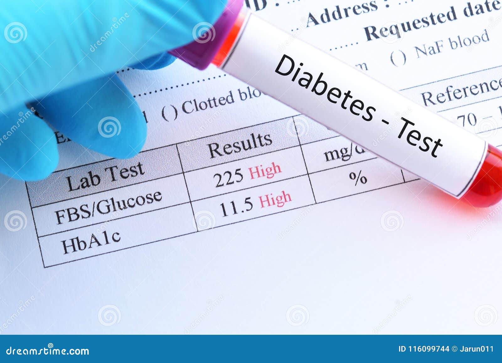Diabetes test result stock photo. Image of test, result - 116099744