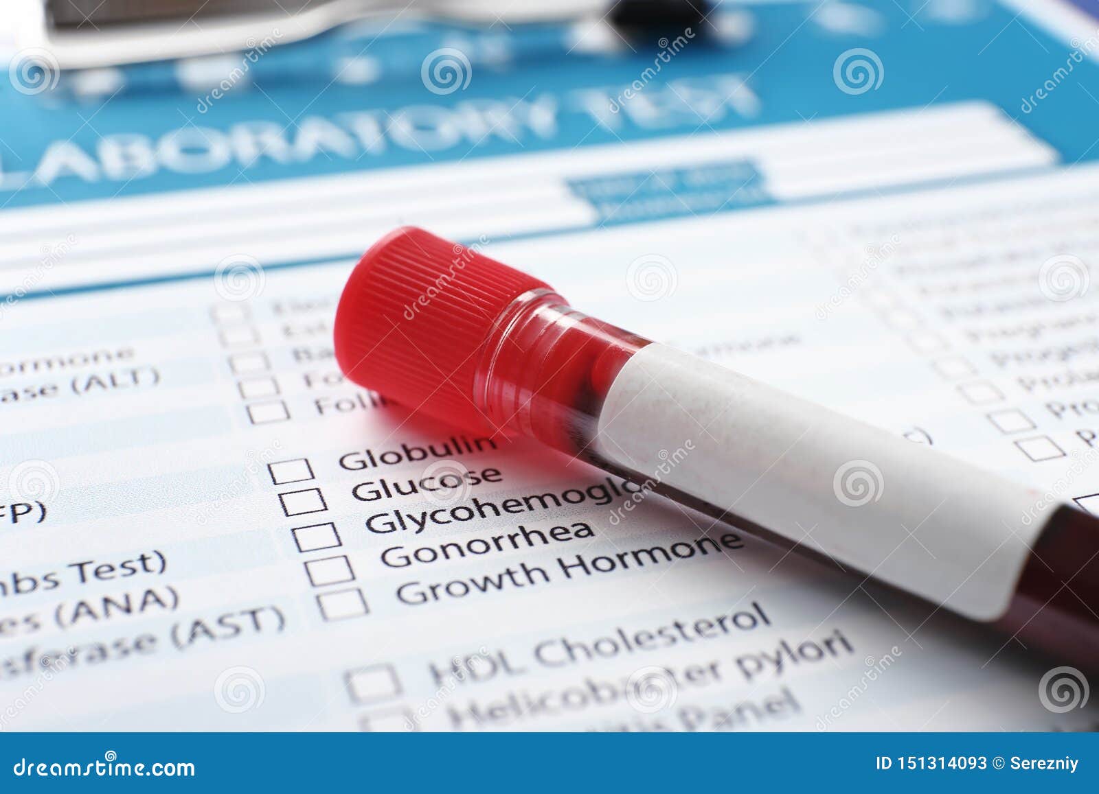 Blood Sample on Document with Result of Analyses, Closeup Stock Image ...