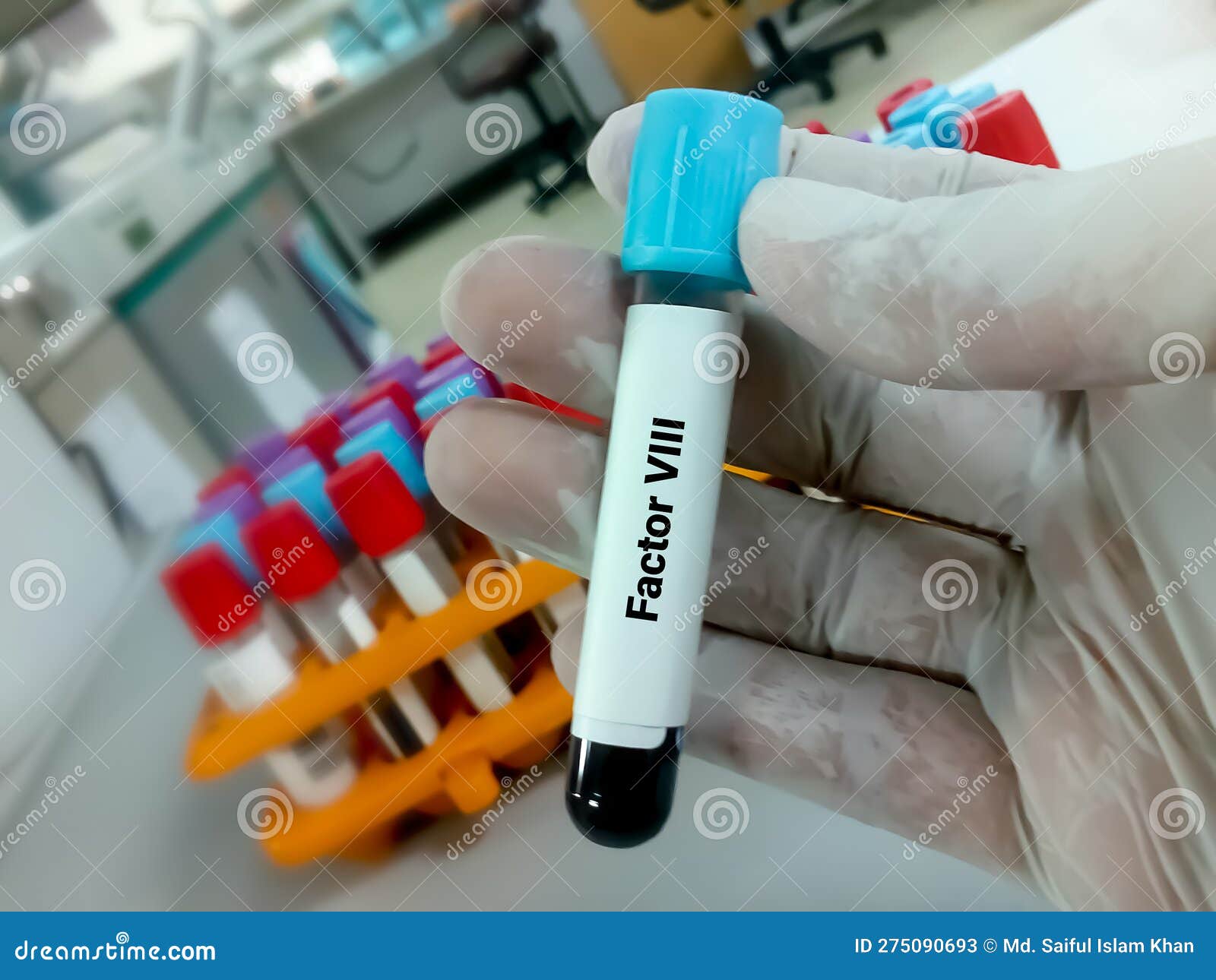 Blood Sample for Factor VIII. Blood Coagulation Testing. Antihemophilia ...