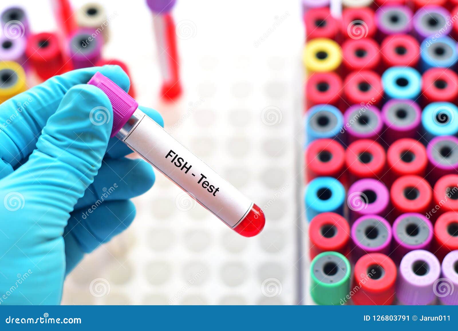 Blood sample for FISH test stock image. Image of double - 126803791