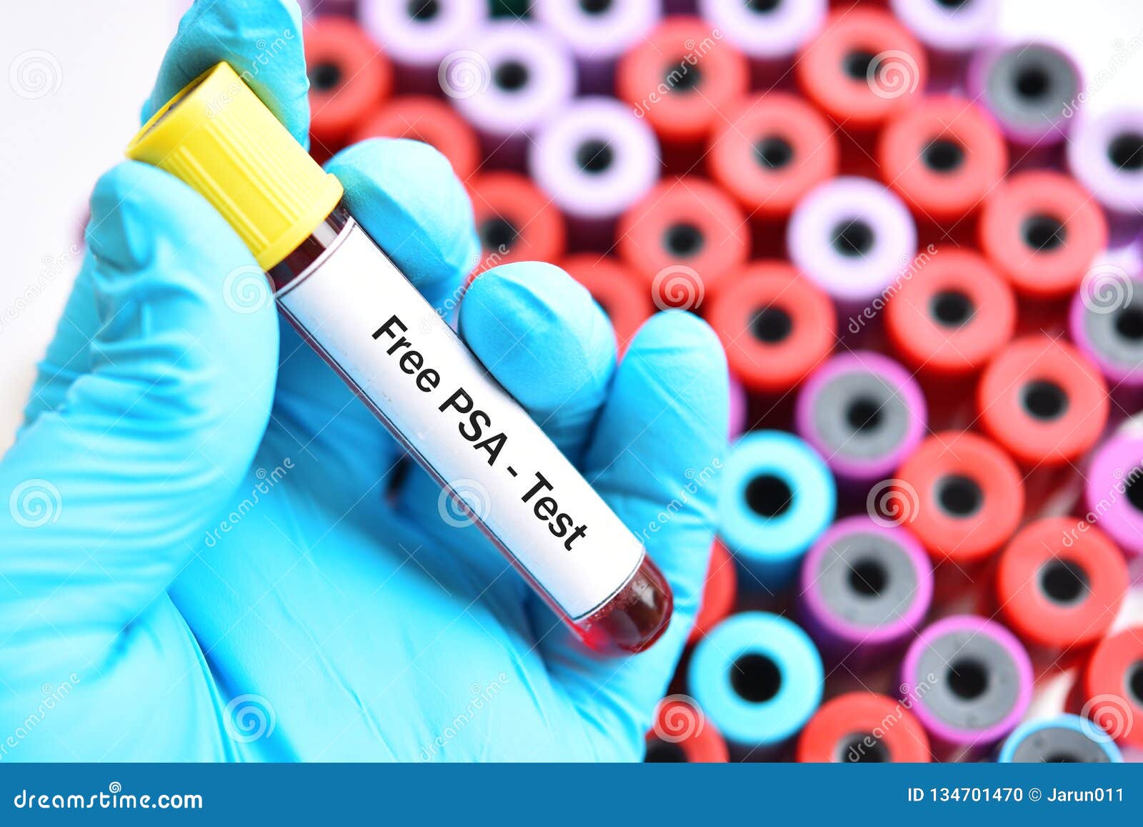 Blood Sample for Free PSA Test Stock Photo - Image of checkup, serology ...
