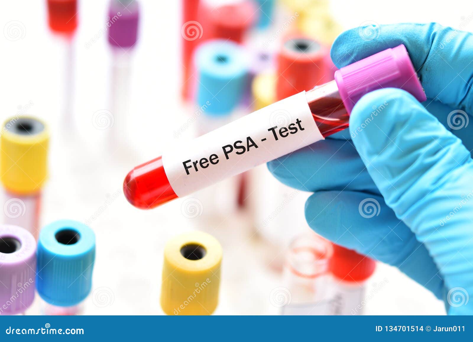 Blood Sample for Free PSA Test Stock Photo - Image of gland, care ...