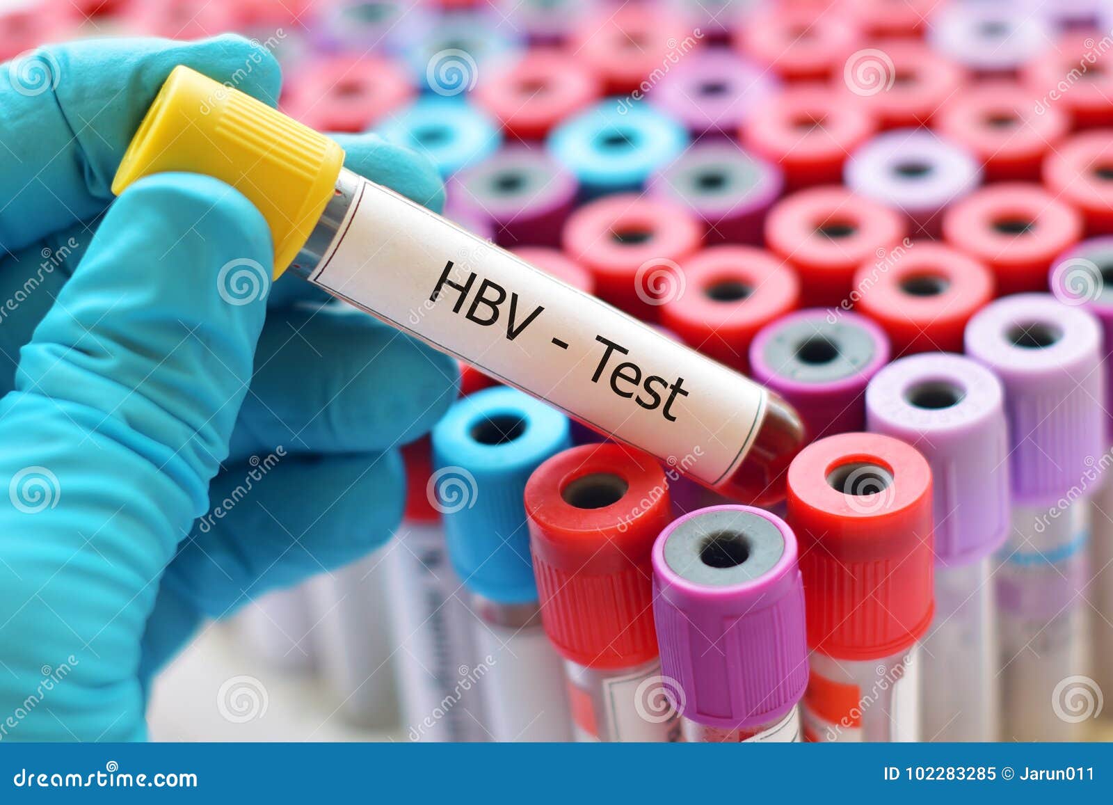 HBV test stock image. Image of medical, exam, biotechnology - 102283285