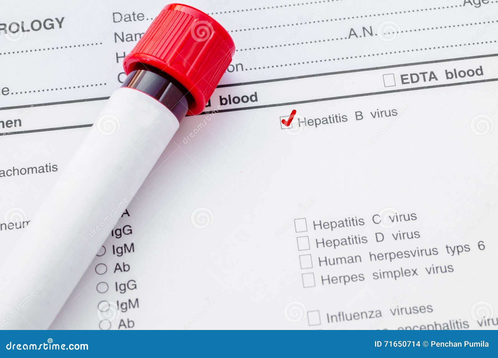 Blood Sample for Hepatitis B Virus (HBV) Testing. Stock Photo - Image ...