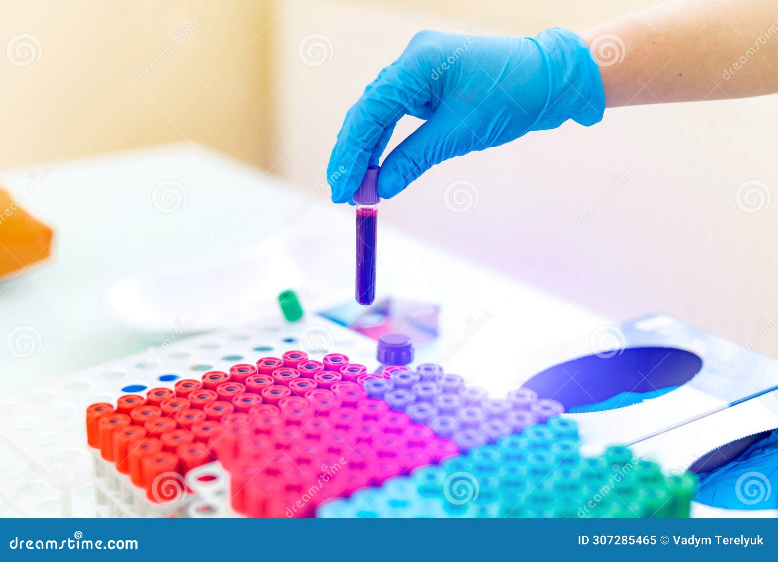 Blood Sample. Lab Technician Holding Blood Tube Sample for Study Stock ...