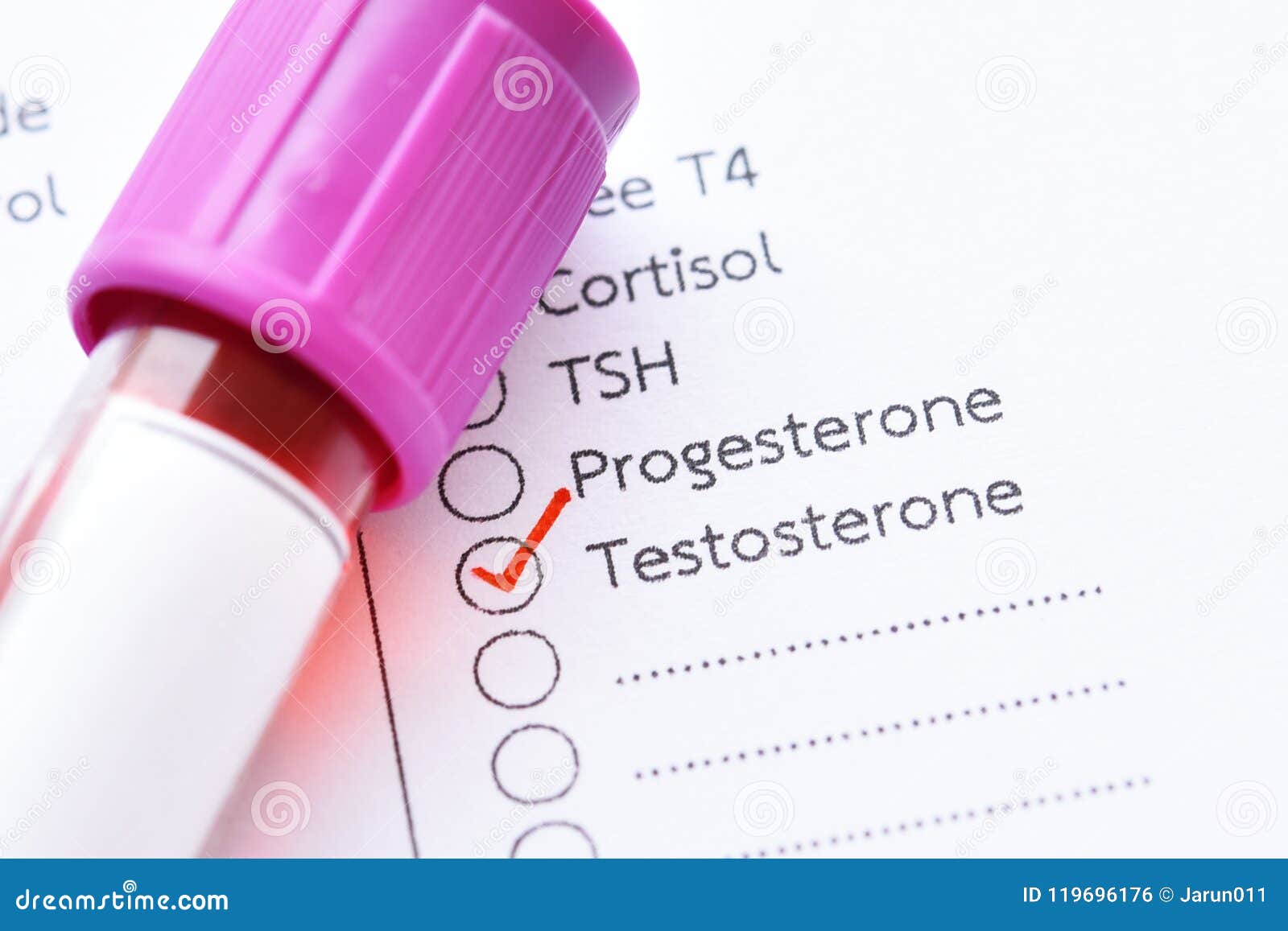 Blood Sample for Testosterone Hormone Test Stock Photo - Image of ...