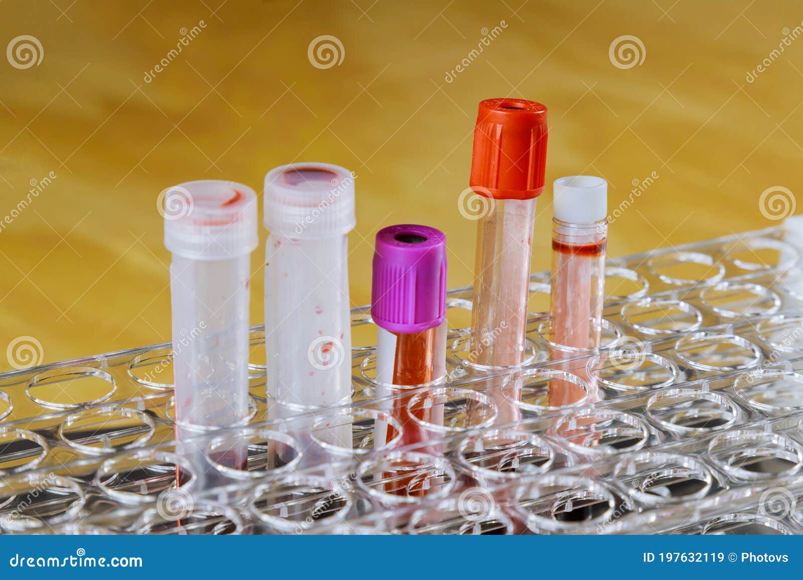 A Blood Sample with in a Laboratory To Check the Sampling Tube Placed ...
