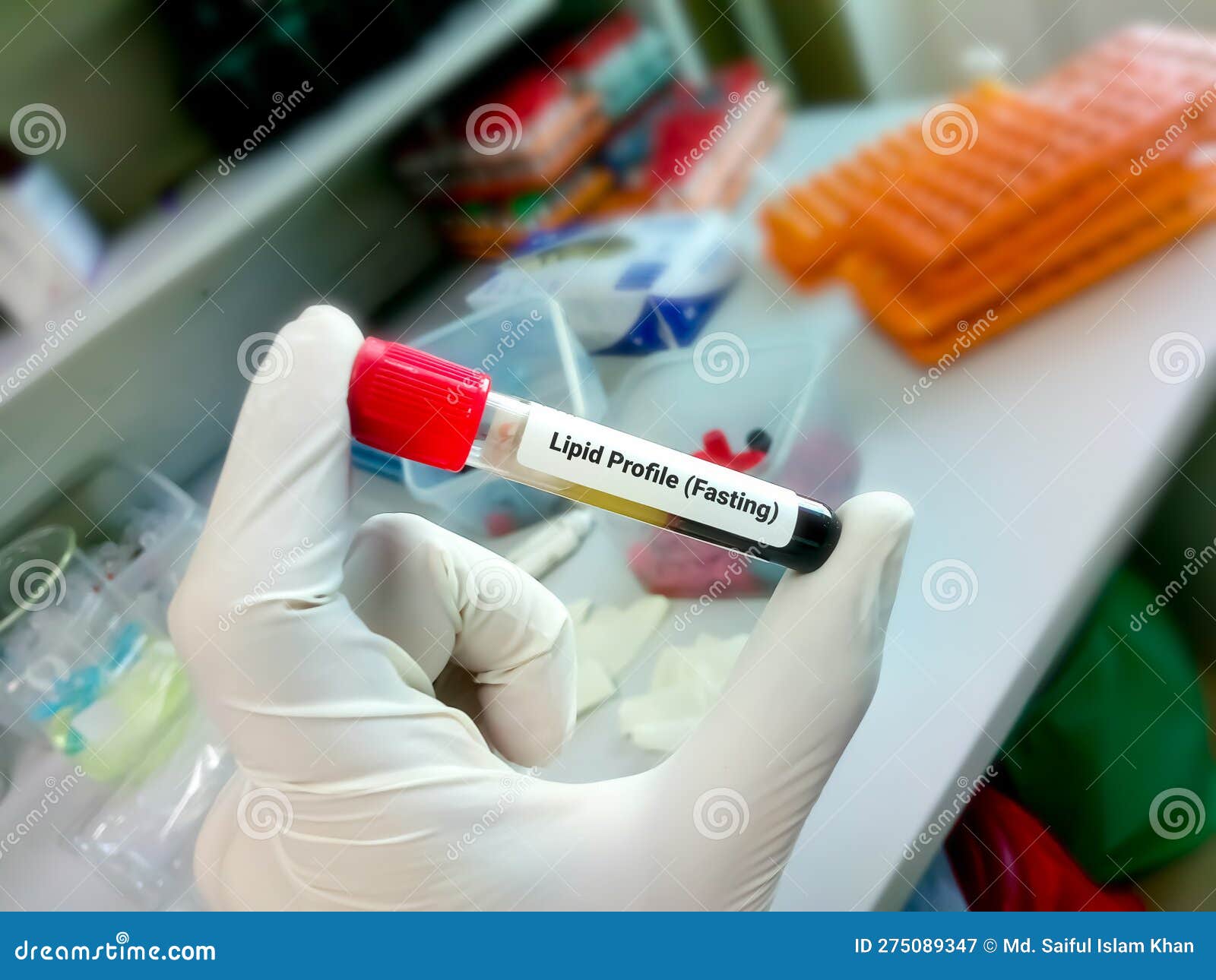 Blood Sample for Lipid Profile Test Stock Image - Image of clot ...
